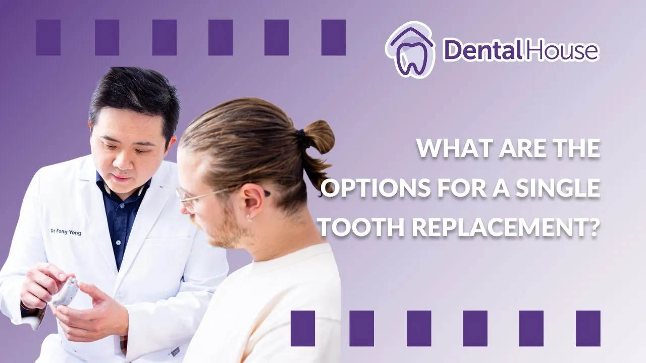 What Are the Options for a Single Tooth Replacement? - Melton Dental House